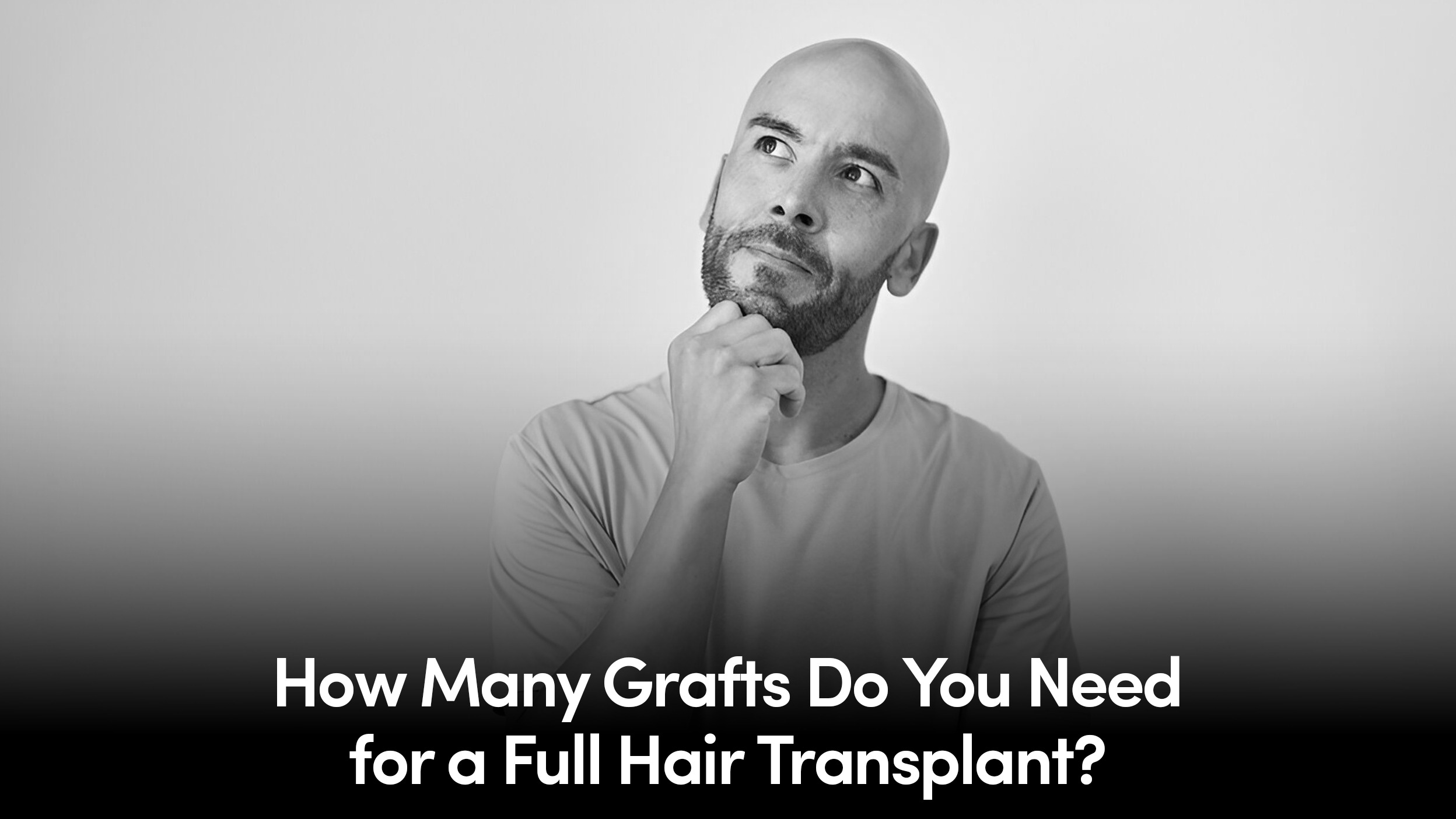 How Many Grafts Needed for Full Hair Transplant - QHT Regrow